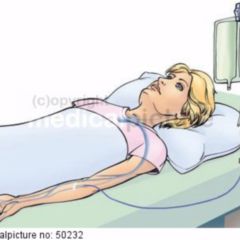 Subkutane Infusion - DocCheck Flexikon