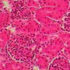 Scl-70-Antikörper - DocCheck Flexikon