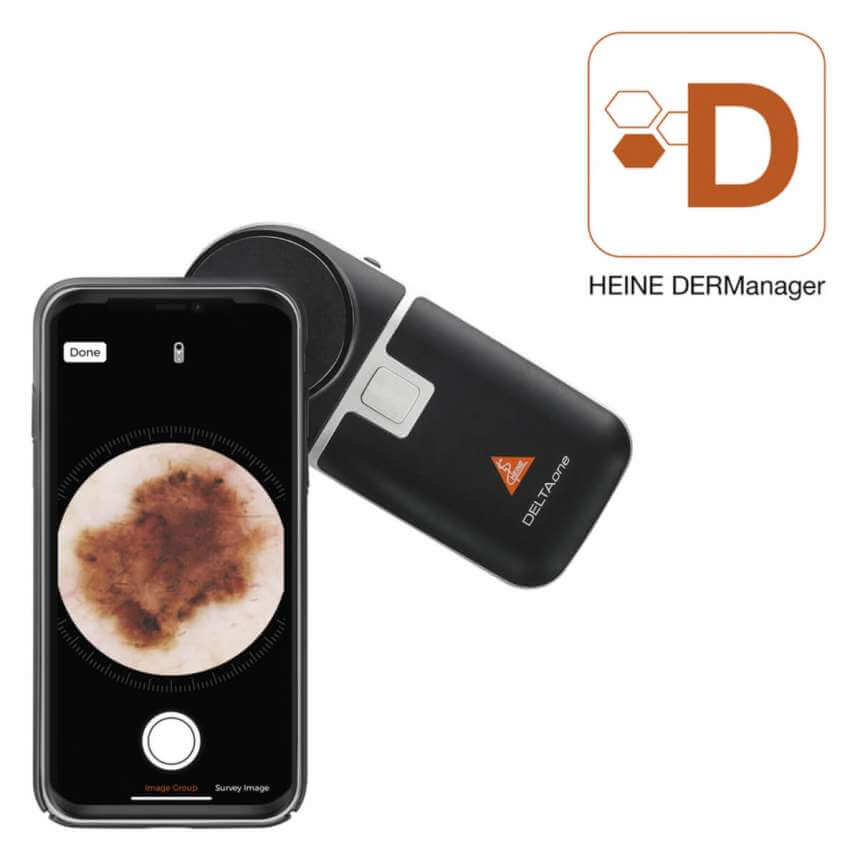 HEINE Optotechnik HEINE DELTAone dermatoscope limited edition ... HEINE Optotechnik HEINE DELTAone dermatoscope limited edition ...